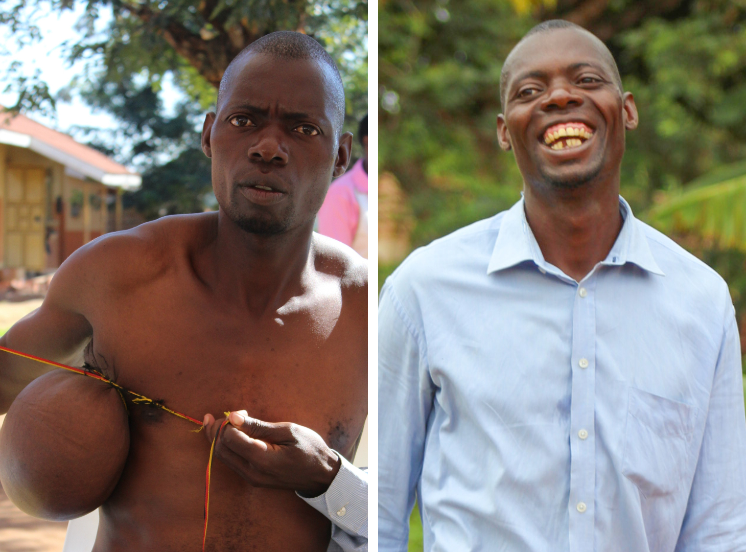 Steven Returns to Health and Work | Bulamu